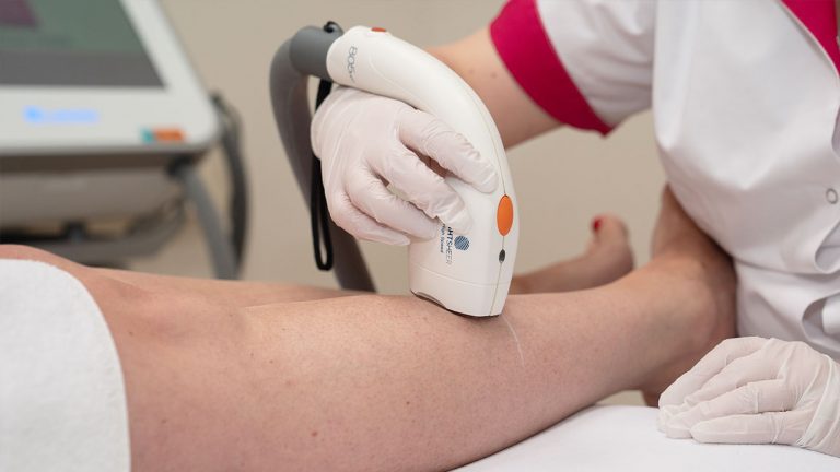 Oedeem Behandeling - Huidzorg Drenthe